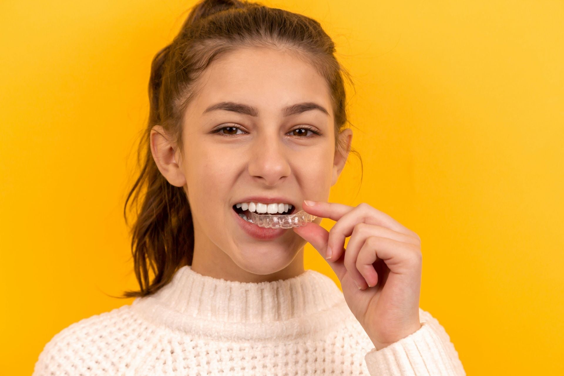 How Much Do Braces Cost UK The Price of Teeth Braces – Smile White UK