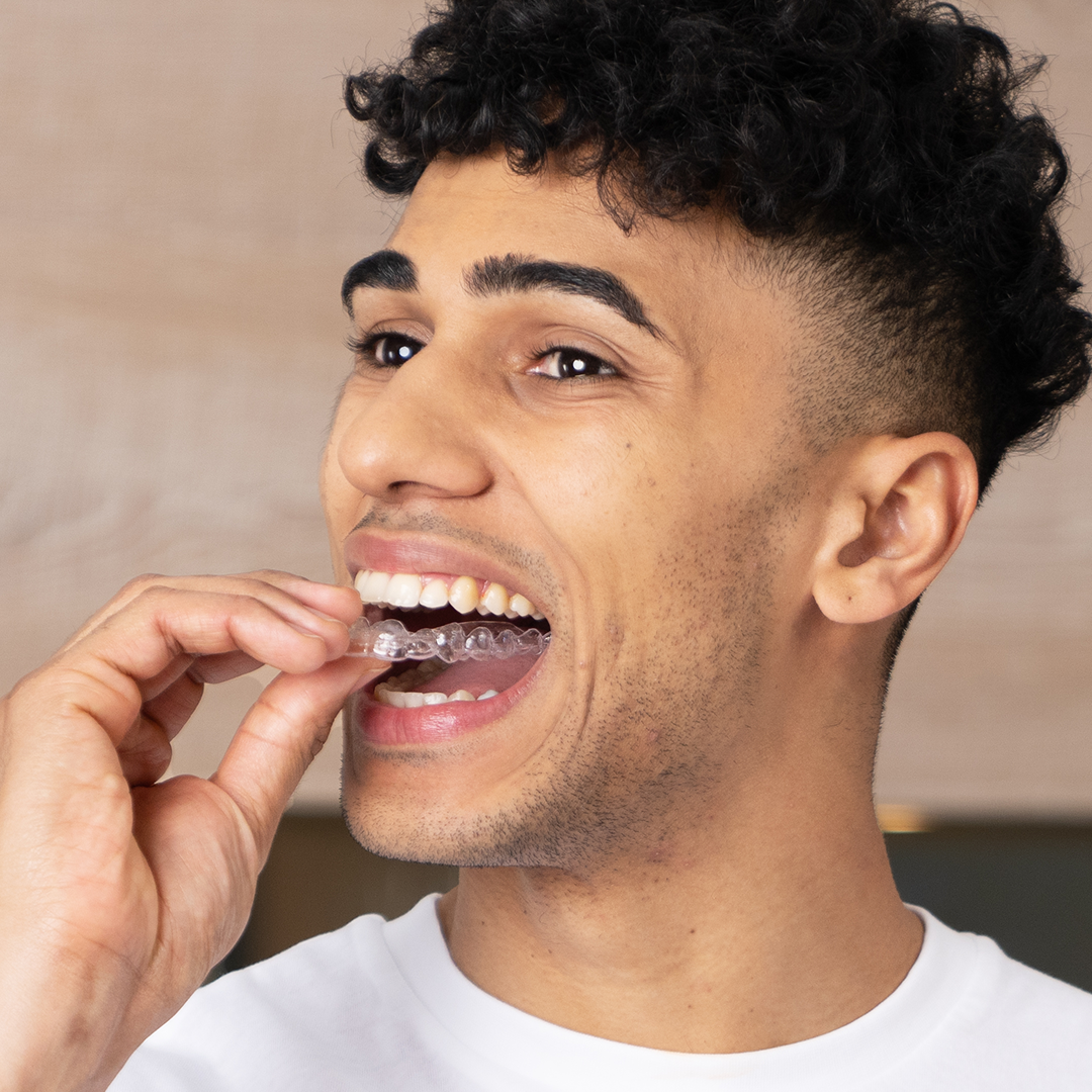 Clear Aligners | Teeth Straightening – SmileWhite UK