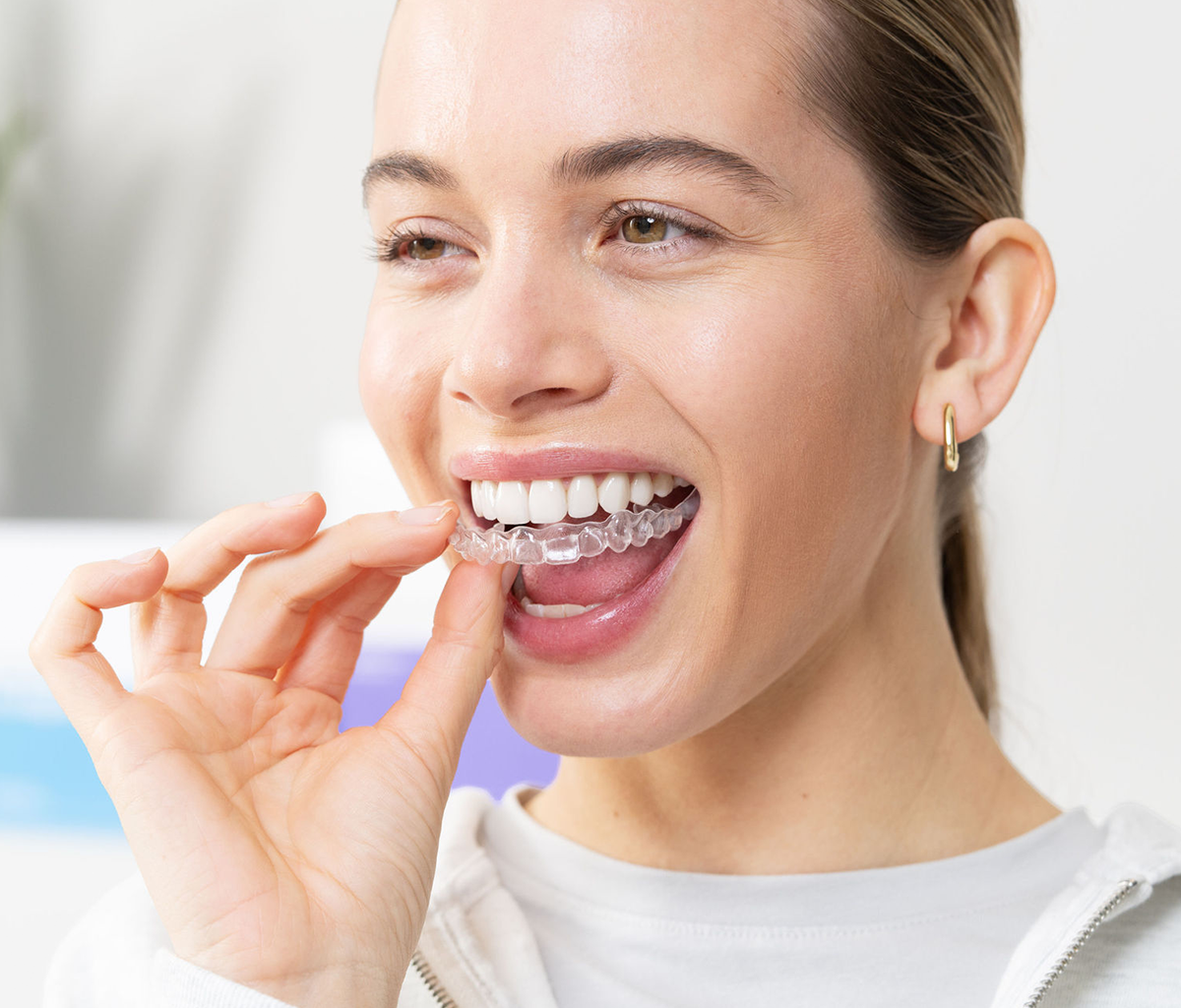 Clear Aligners | Teeth Straightening – SmileWhite UK