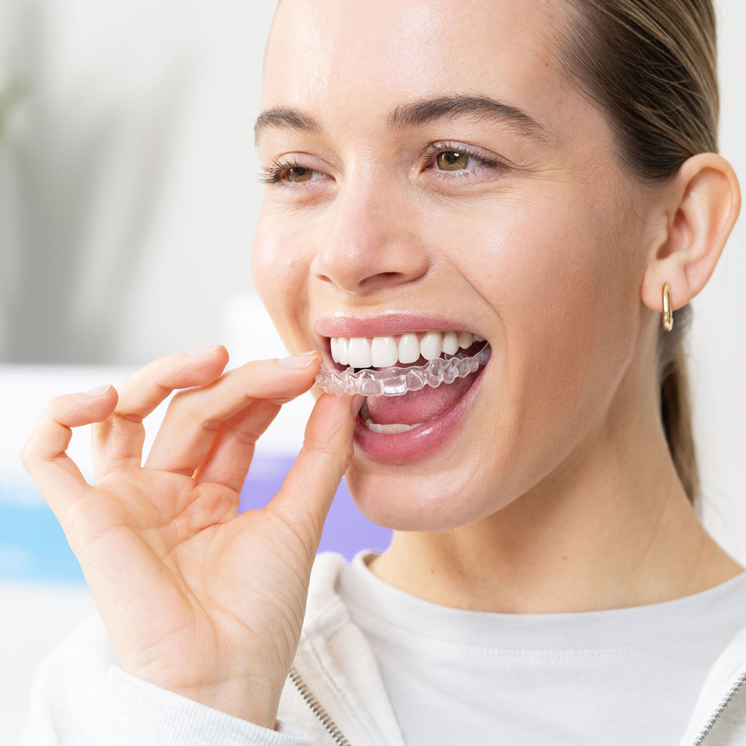 Teeth Aligners & Teeth Straightening – Smile White – Smile White UK