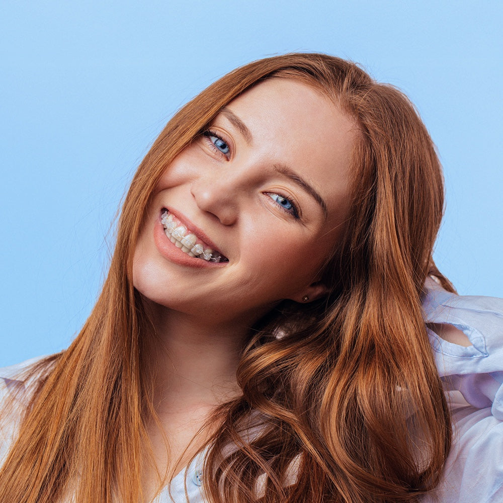 Complex Plus Ceramic Braces – Smile White UK